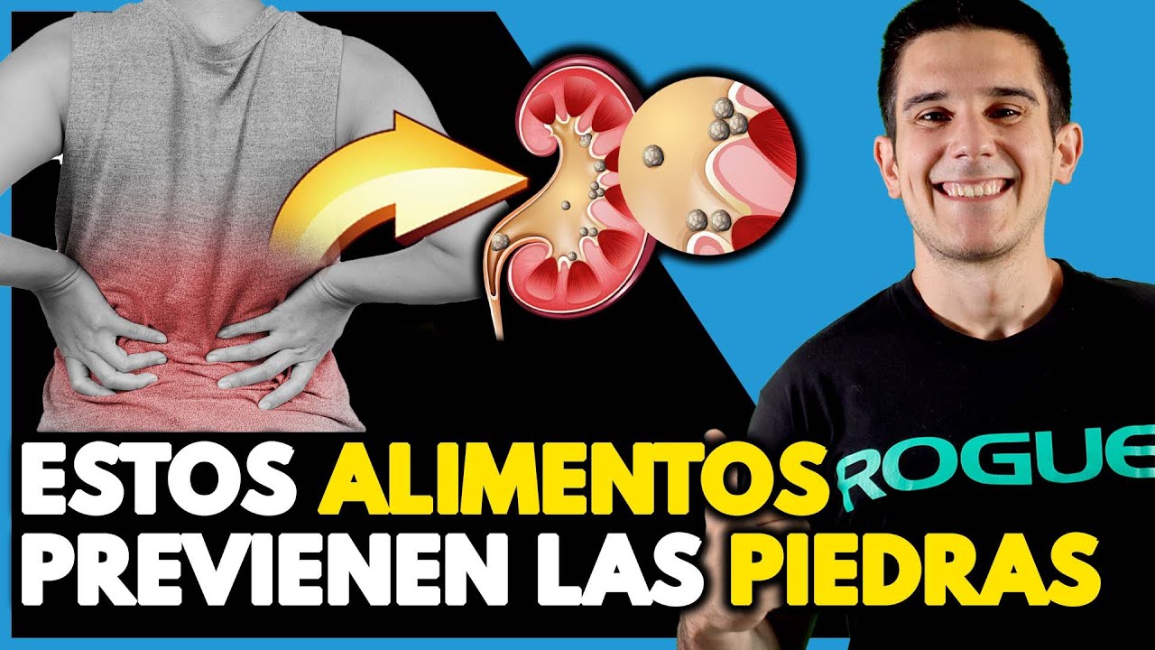 Agua Solán de Cabras Prevención y tratamiento de piedras en riñón ...